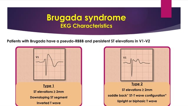 Mastering EKG- presentation-1234456.pptx