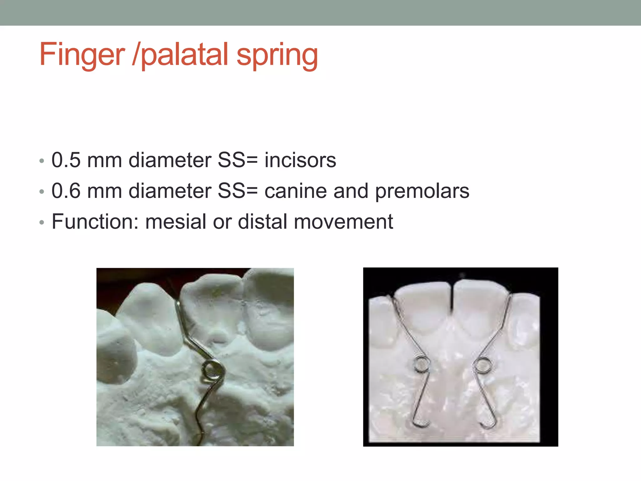 Mastering orthodontic appliances | PPTX