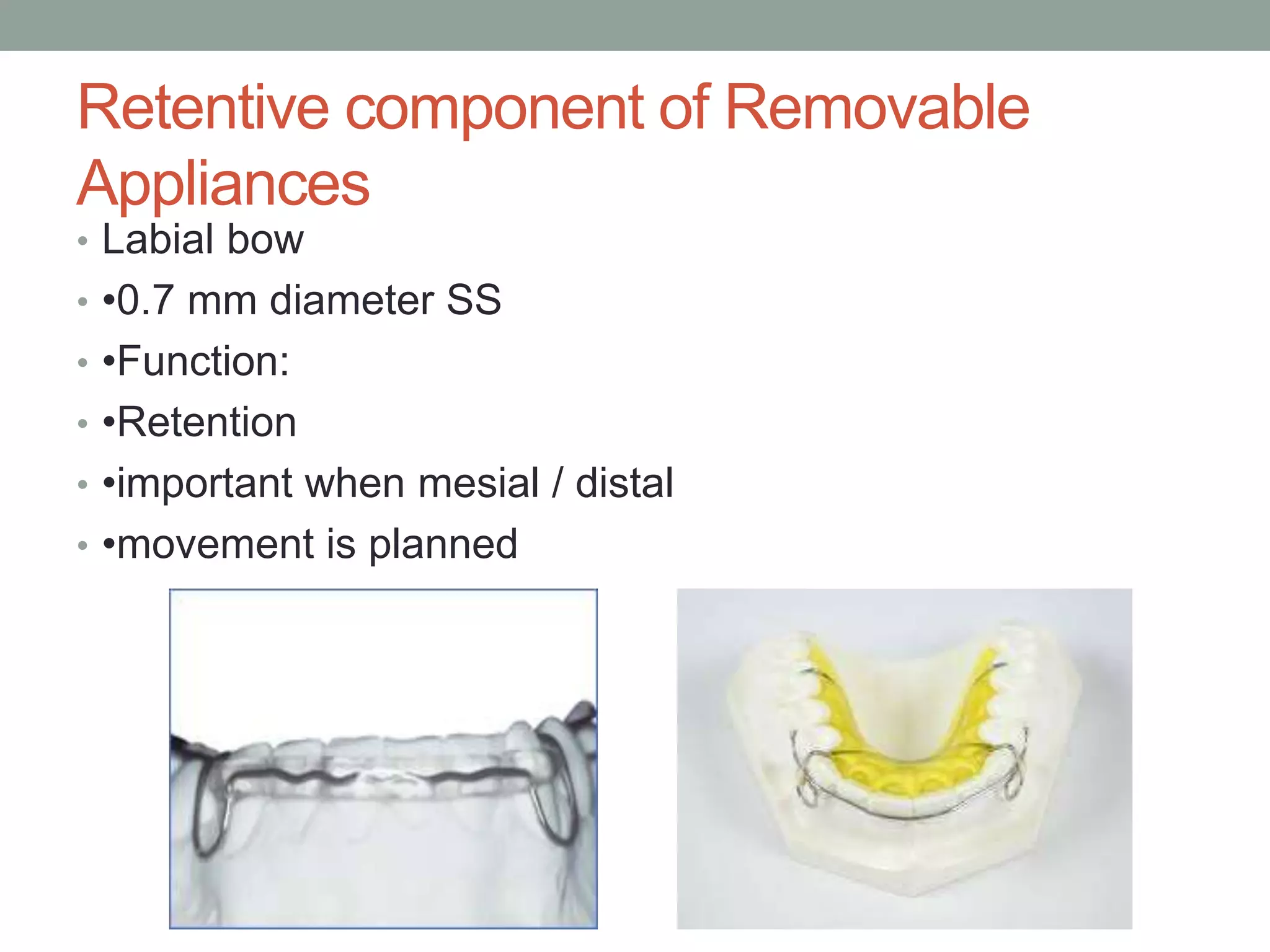 Mastering orthodontic appliances | PPTX