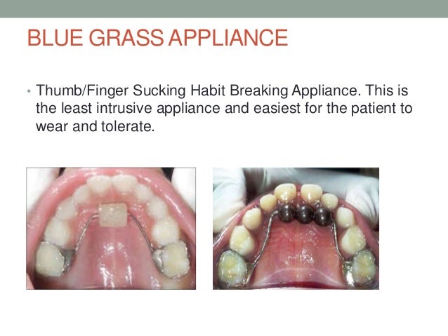 Mastering orthodontic appliances