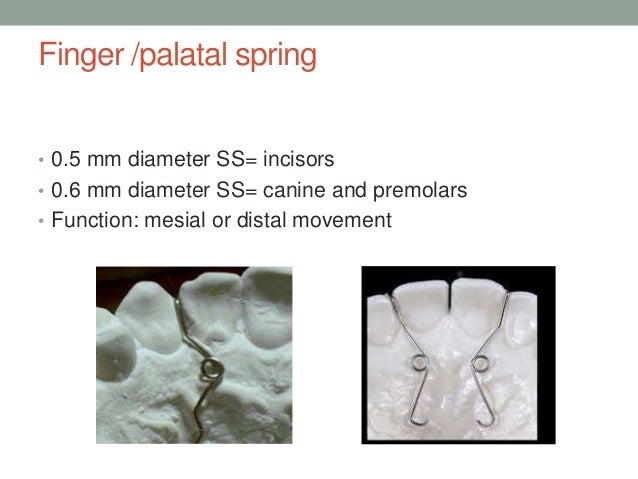 Mastering orthodontic appliances