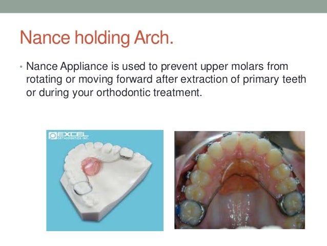 Mastering orthodontic appliances