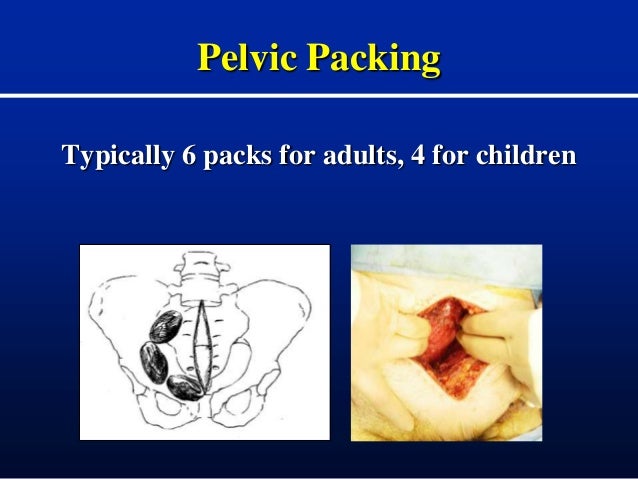 Day 2 | CME- Trauma Symposium | Master trauma panel perspective