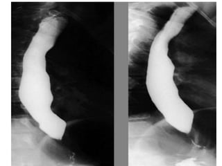 Physiology Of GIT Mastication and Deglutition reflex.pptx