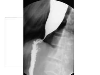 Physiology Of GIT Mastication and Deglutition reflex.pptx