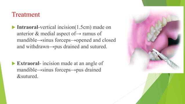 masticatoryspaceinfection-180415103143.pdf