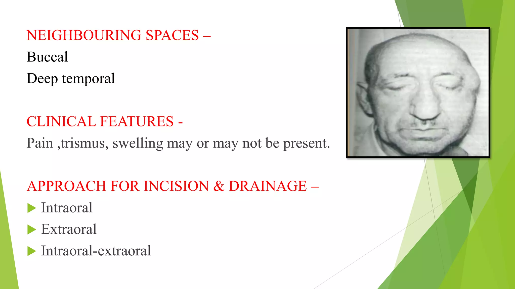 Masticatory space infection | PPTX