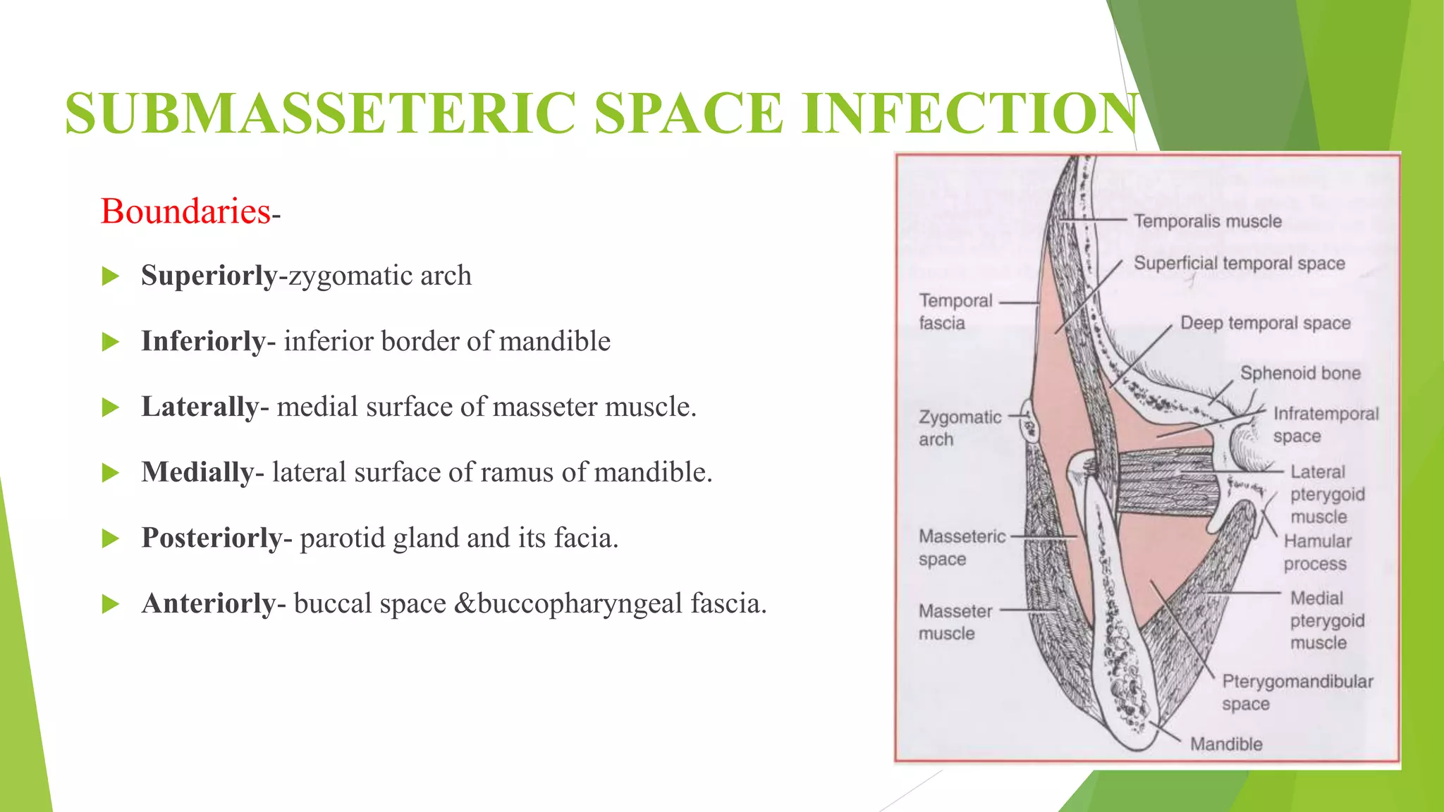 Masticatory space infection | PPTX