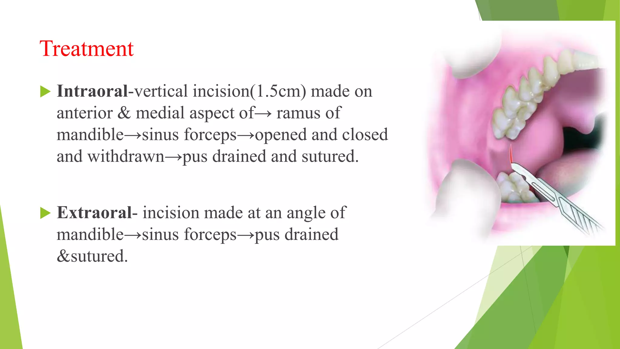Masticatory space infection
