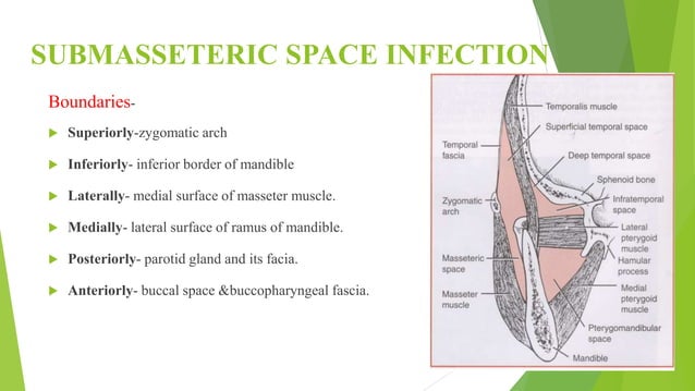 Masticatory space infection | PPTX