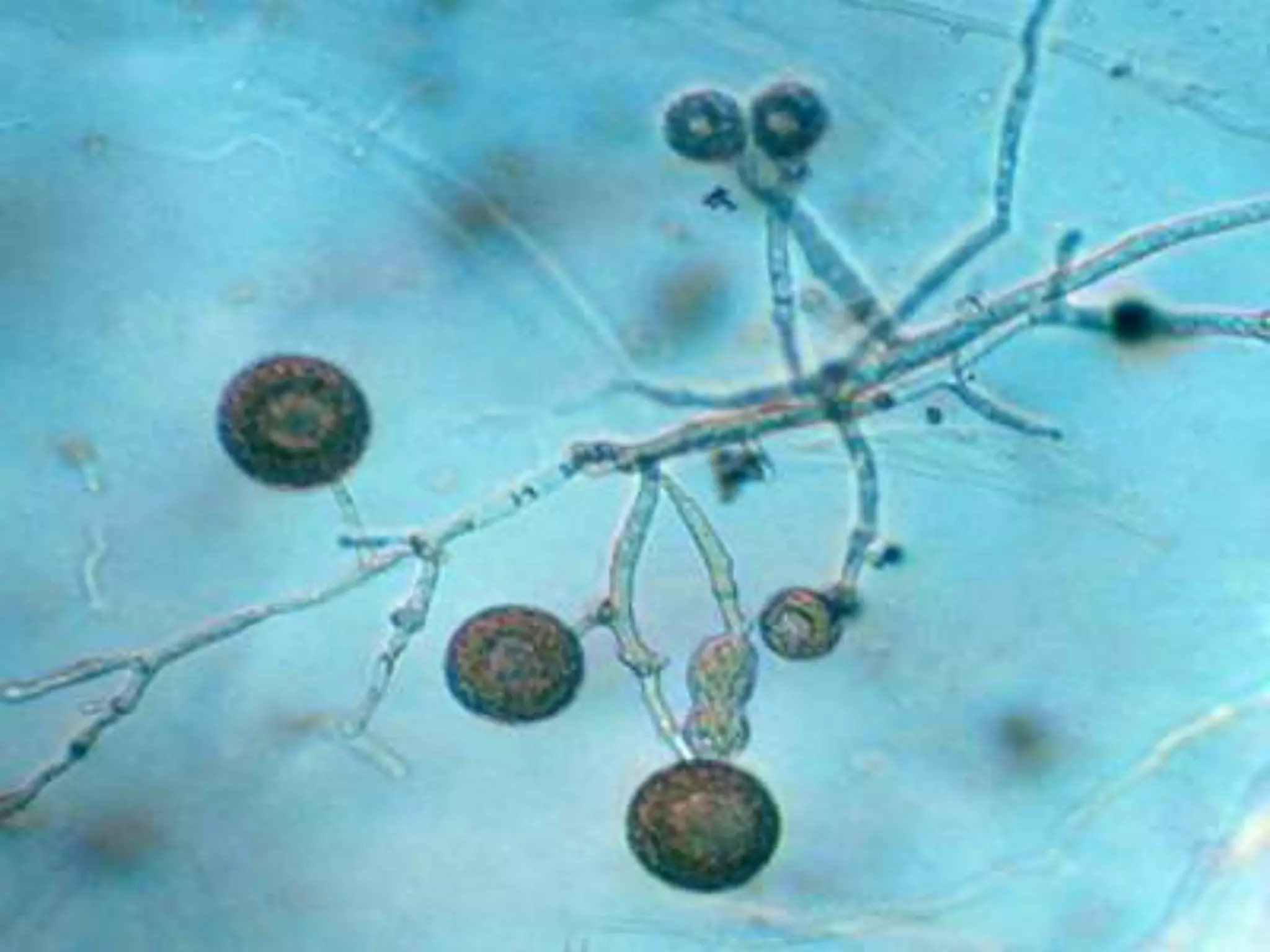 Mastigomycotina | PPTX