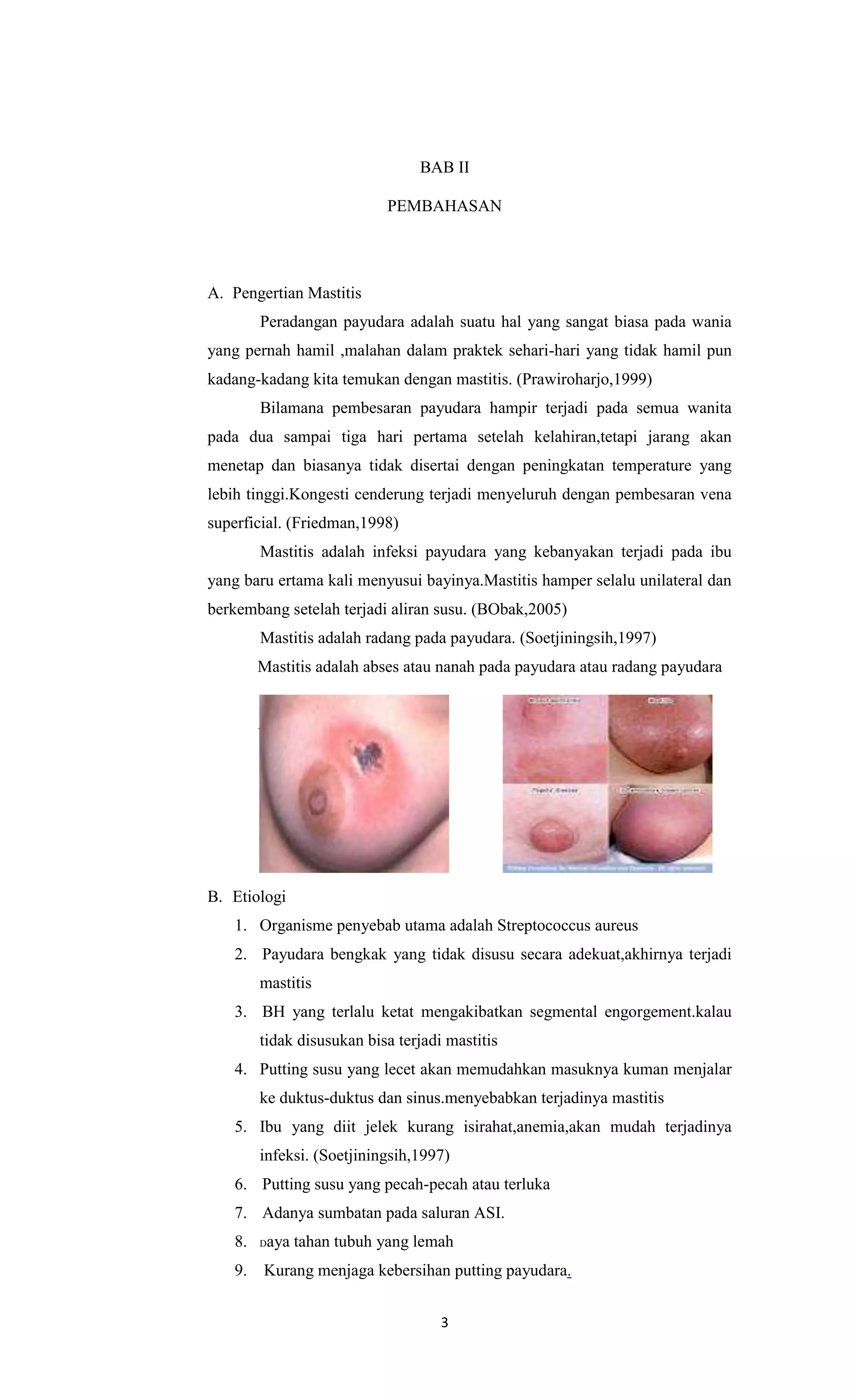 Mastitis | PDF