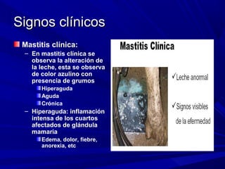 Mastitis | PPT