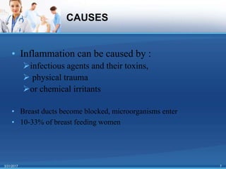 Mastitis BY Norbert at UR- CMHS - CLINICAL MEDICINE | PPTX
