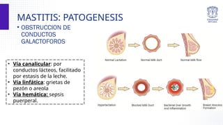 MASTITISCRONICASYAGUDASMASTITIS GRANULOMATOSA.pptx