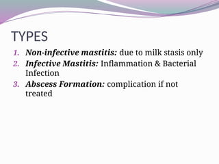 mastitis.pptx. overview of mastitis & it's treatment | PPTX