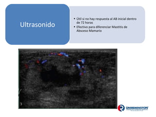 MASTITIS | PPT