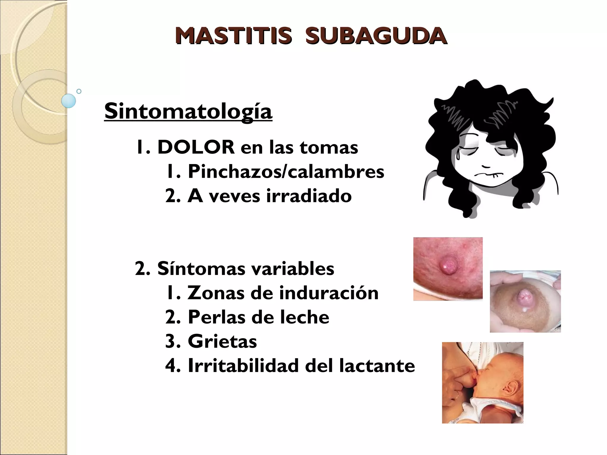 Mastitis y lactancia materna | PPT