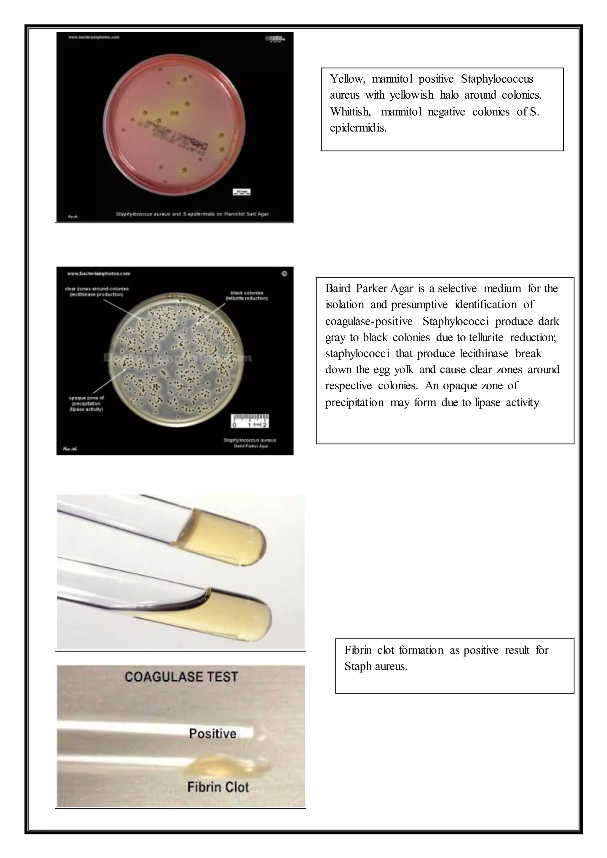Laboratory diagnosis of bovine mastitis bacteria. | DOCX | Ear, Nose ...