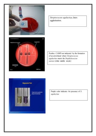 Laboratory diagnosis of bovine mastitis bacteria. | DOCX | Ear, Nose ...