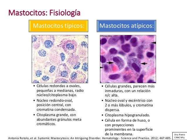 Mastocitosis