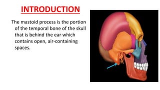 Mastoditis 170811051118 | PDF