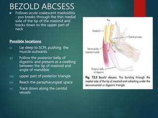 MASTOID ABSCESS, ear nose and throat presentation | PPT