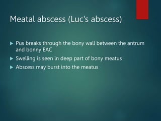MASTOID ABSCESS, ear nose and throat presentation | PPT