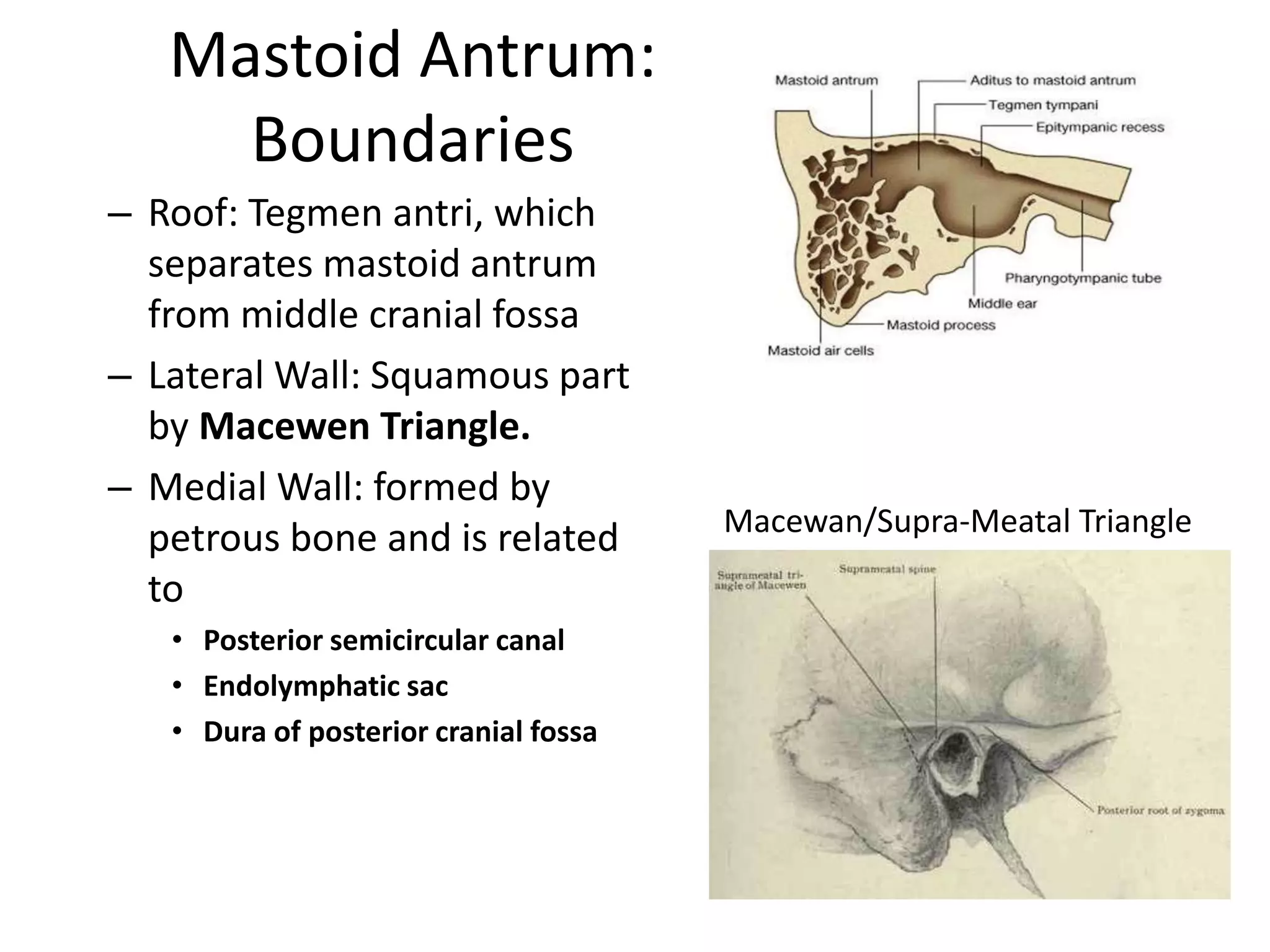 Mastoid diseases imaging | PPTX