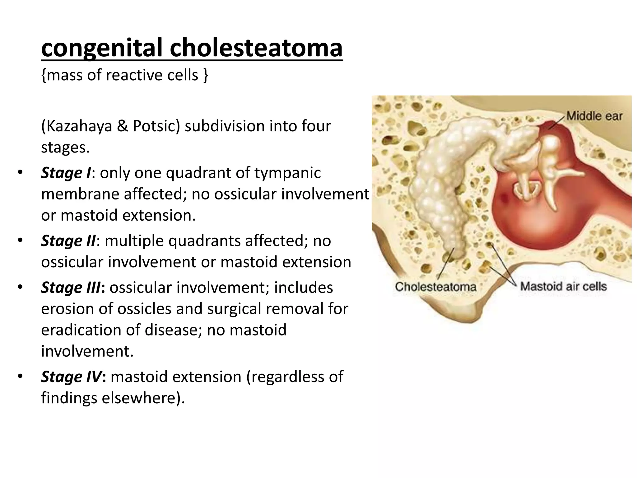 Mastoid diseases imaging | PPTX