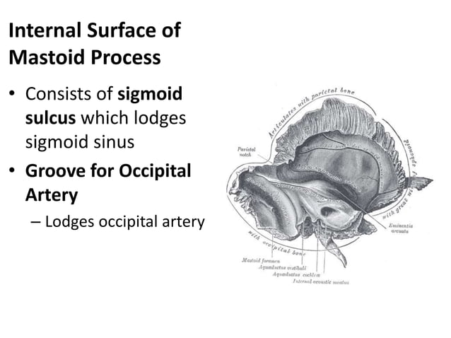 Mastoid diseases imaging | PPTX