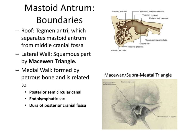 Mastoid diseases imaging | PPTX