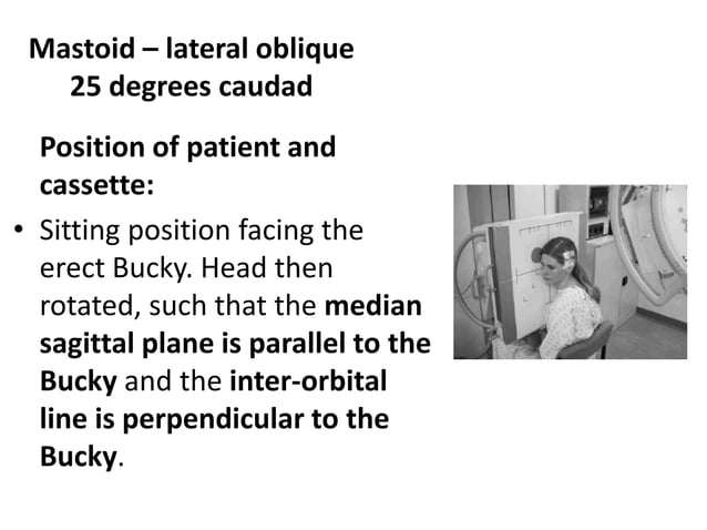 Mastoid diseases imaging | PPTX