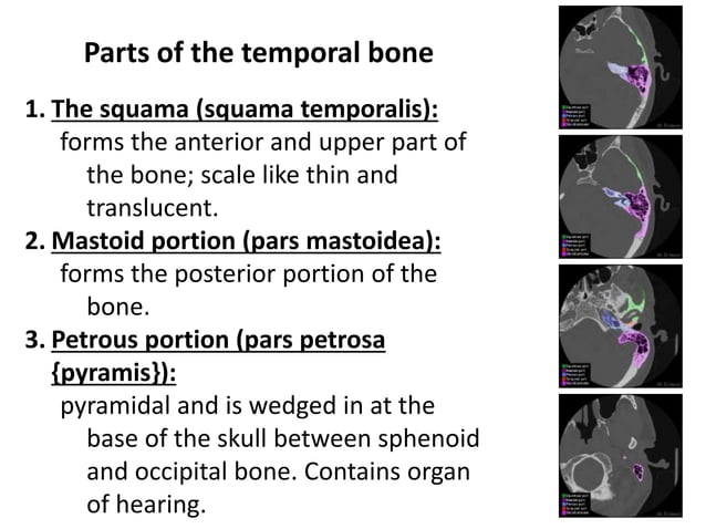 Mastoid diseases imaging | PPTX