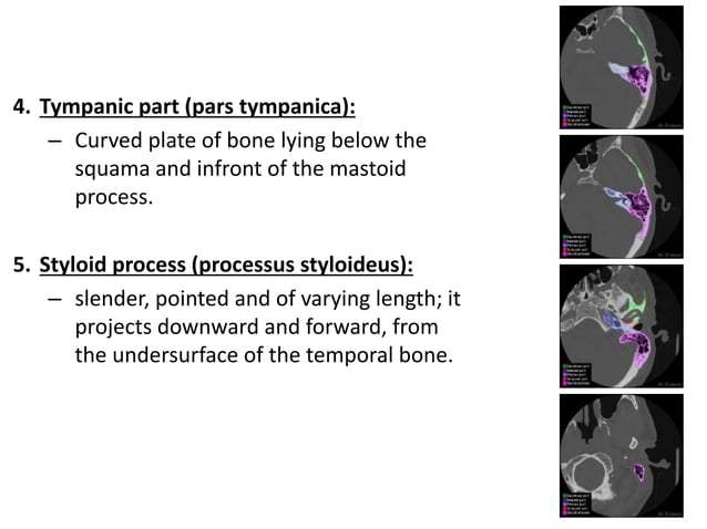 Mastoid diseases imaging | PPTX