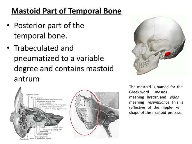 Mastoid diseases imaging | PPTX