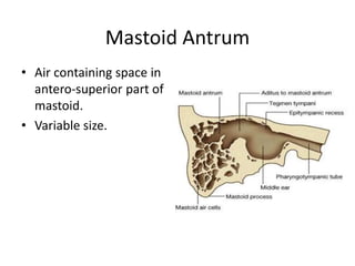 Mastoid Antrum