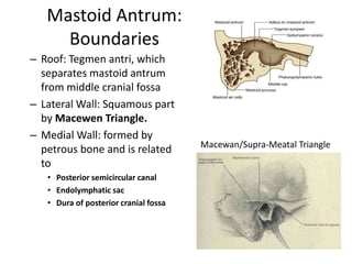 Mastoid Antrum