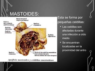 Mastoidectomía | PPTX