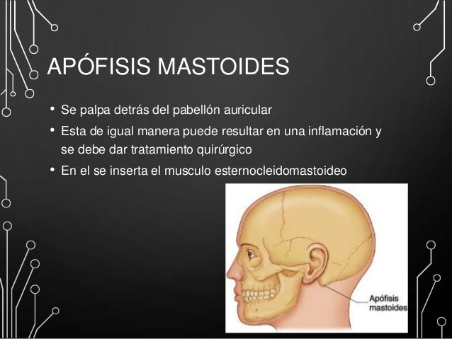 Mastoidectomía