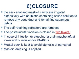 Mastoidectomy | PPT