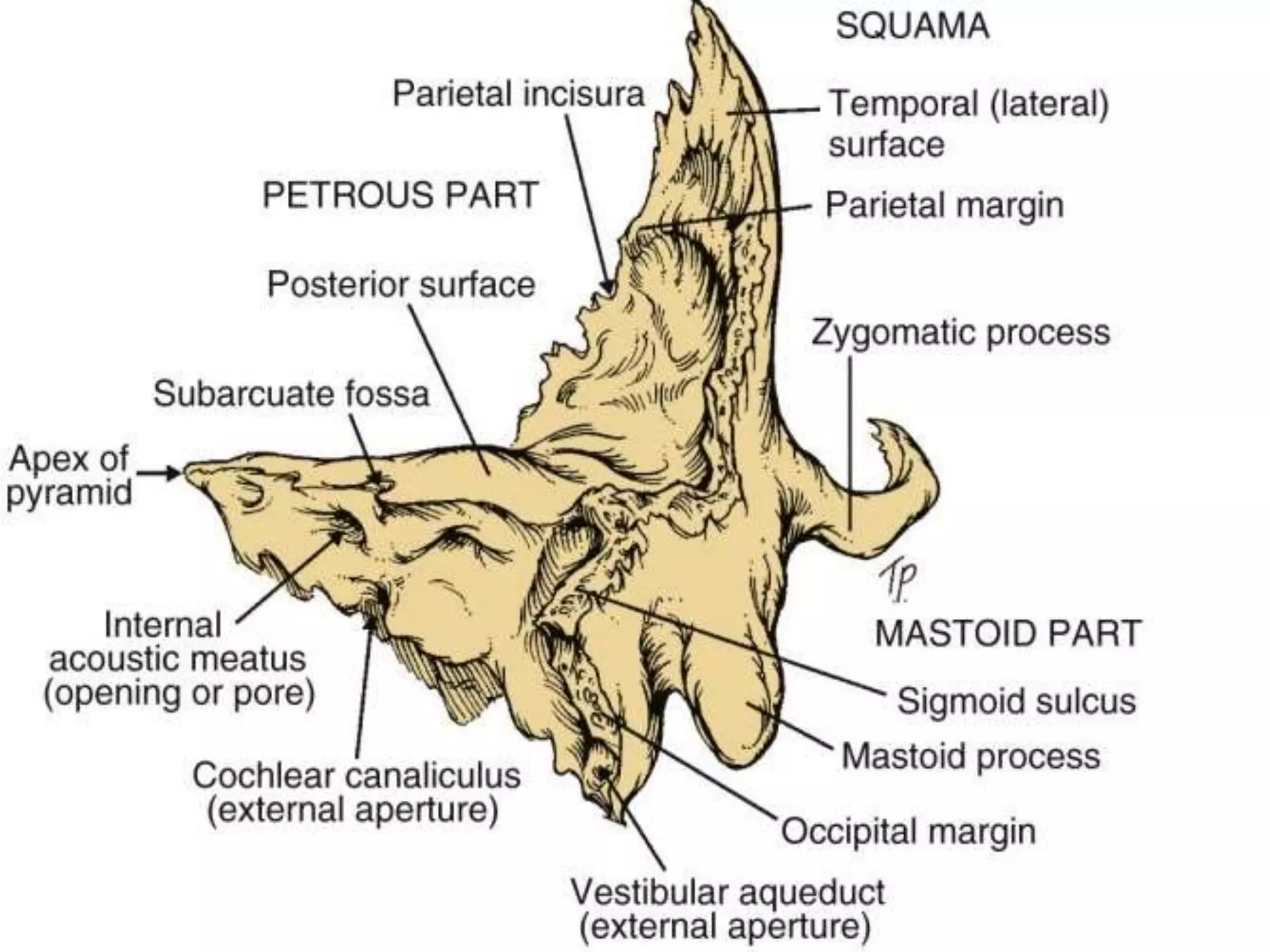Mastoidectomy; Types, Indications, Procedure | PDF