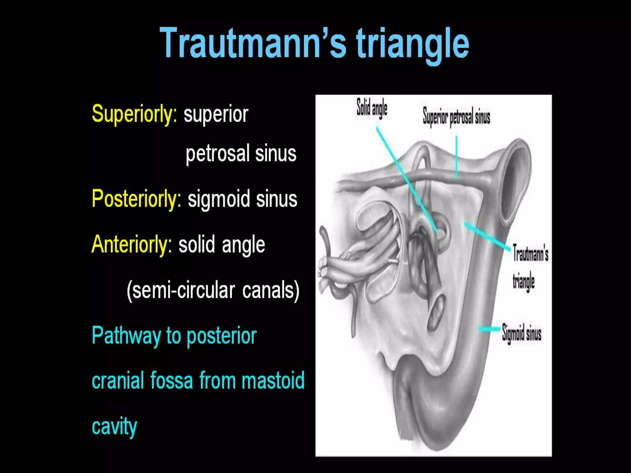 Mastoidectomy; Types, Indications, Procedure | PDF