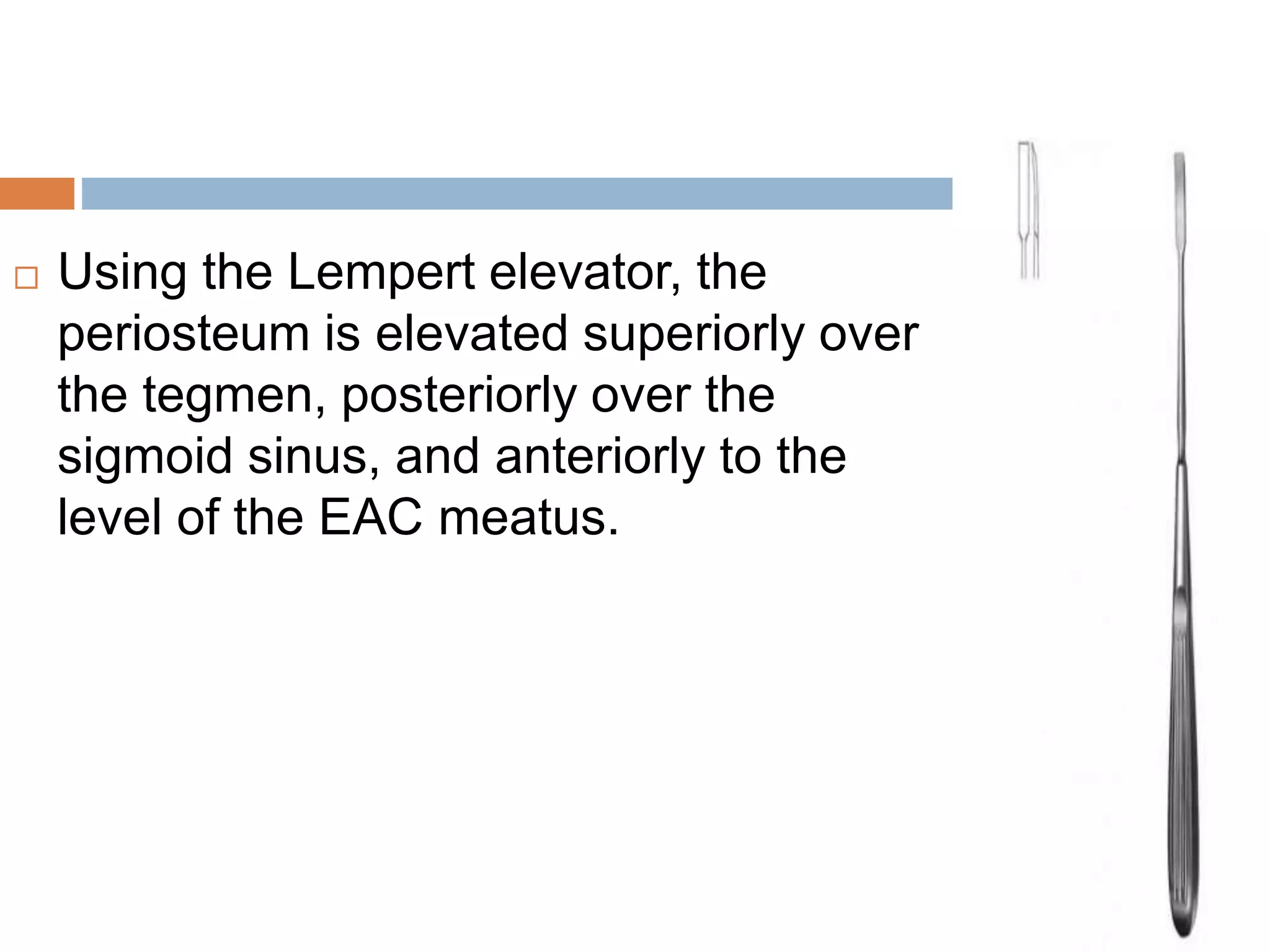 Mastoidectomy; Types, Indications, Procedure | PDF