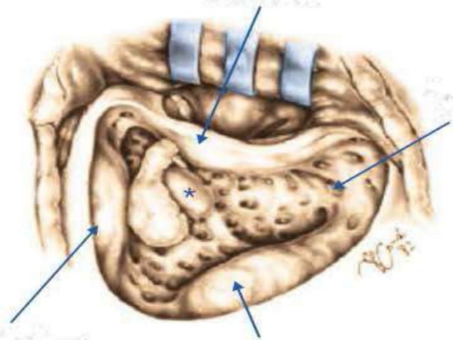 Mastoidectomy; Types, Indications, Procedure | PDF