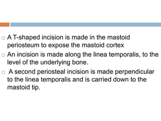 Mastoidectomy; Types, Indications, Procedure | PDF