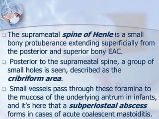 Mastoidectomy (by drdhiru456) | PPTX