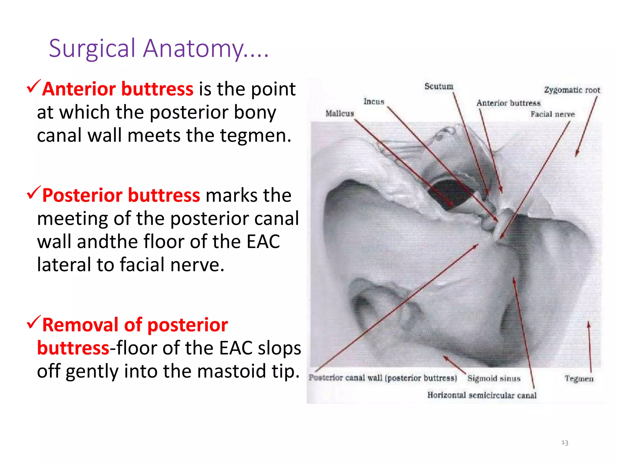 MASTOIDECTOMY PPT | PPT