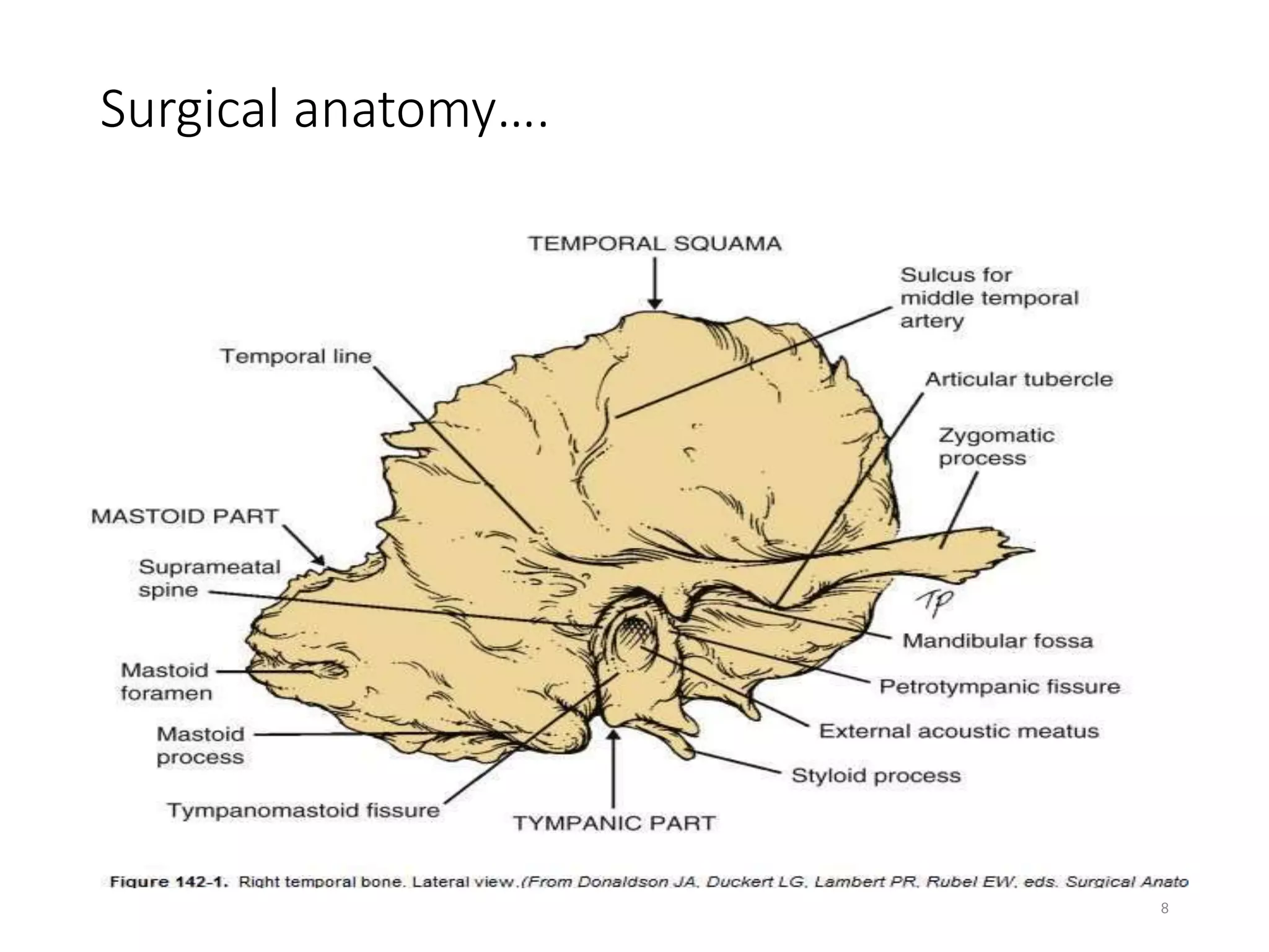 MASTOIDECTOMY PPT | PPT