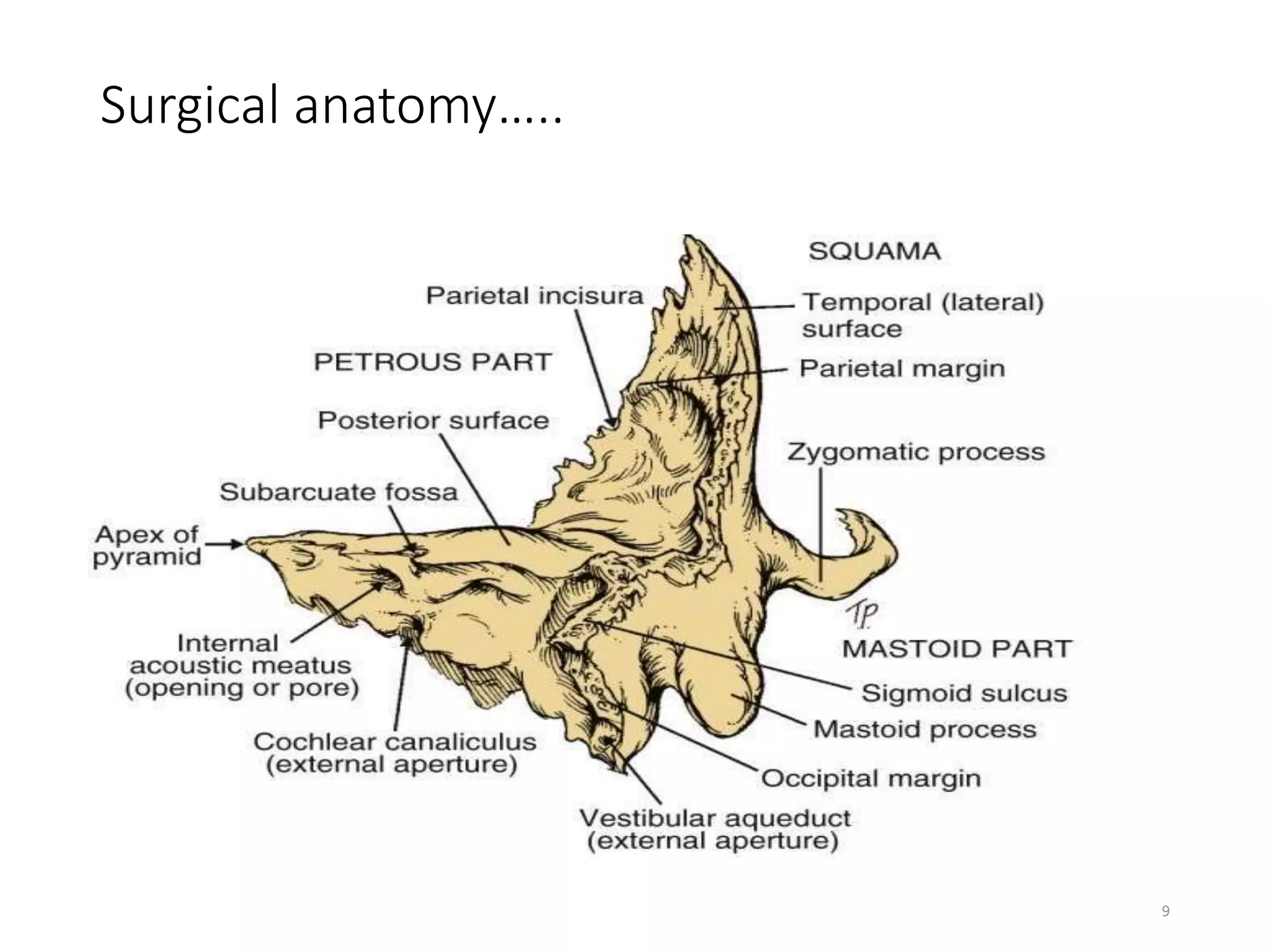 MASTOIDECTOMY PPT | PPT